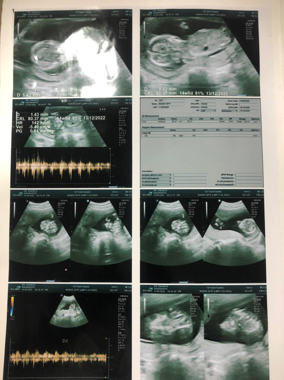 lis.immunodiag.com - /immuno/Uploaded Document/20220701/